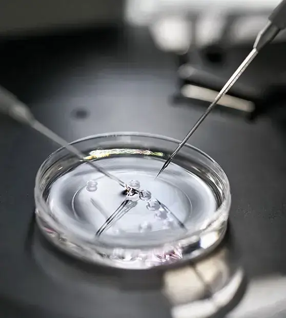 Intra-Cytoplasmic Sperm Injection (ICSI) Treatment in UAE