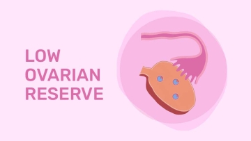 Low Ovarian Reserve: Understanding Causes, Identifying Symptoms, and ...